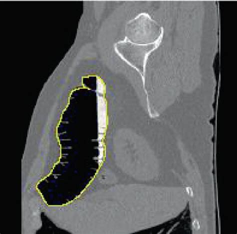 The Intestinal Segmentation Effect Download Scientific Diagram