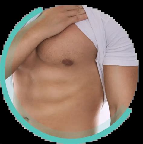 Gynecomastia Vamhealthcare