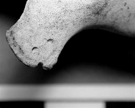 Close Up Of Angular Process Of Right Mandible Of Archaeological Download Scientific Diagram