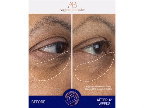 Augustinus Bader The Eye Cream Complete Set Lovelyskin