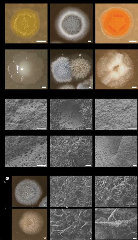 Phenotypic Characterization Of Actinobacteria Isolated From A Faecal Download Scientific