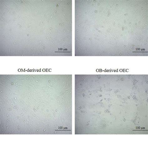 Morphological Difference Of Purified Oecs On Day 7 And 28 Post Download Scientific Diagram