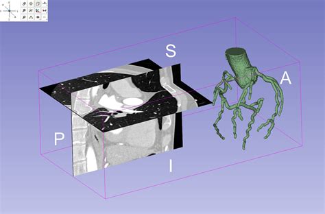 3d model to segmentation support 3d slicer community