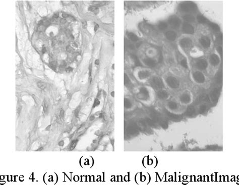 Figure From Deep Learning Based Breast Cancer Classification Using Artificial Neural Network