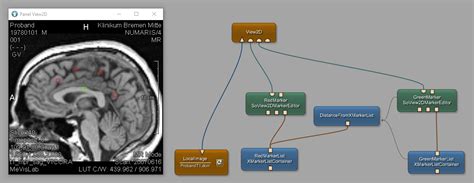 Distance Between Markers