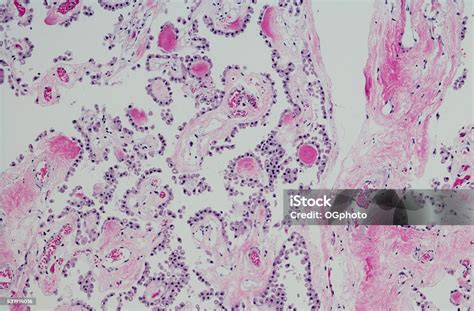 Choroid Plexus Histology