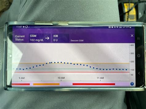 Started Using The Omnipod 5 In Automatic Mode Paired With My Dexcom G6 R Diabetes