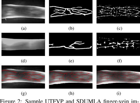 Table 1 From Finger Vein Recognition Using Deep Fully Convolutional