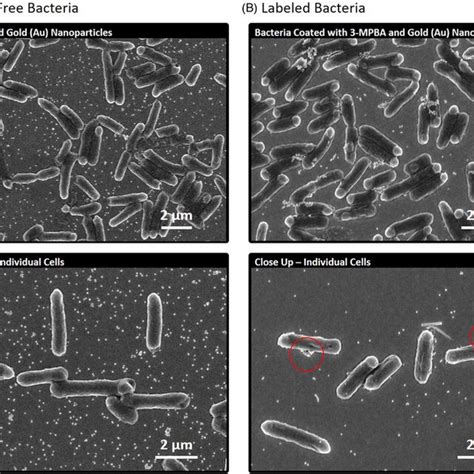 Electron Micrographs Of The Bacteria Samples As They Were Analyzed