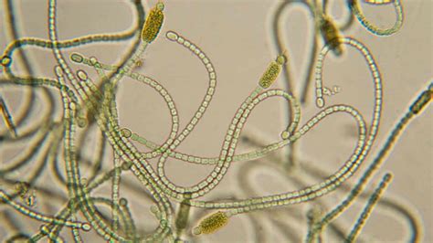 Devastating Effects Of Cyanotoxins On Human Health