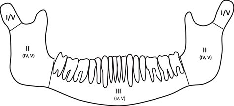 Mandible Fracture Classification
