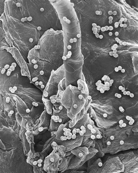 Enterococcus Faecium On Human Skin Sem Stock Image C037 0079 Science Photo Library
