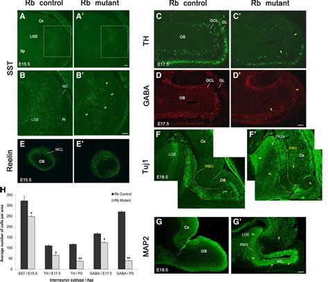 Loss Of Specific Interneuron Subtypes And Migration Defects In Rb