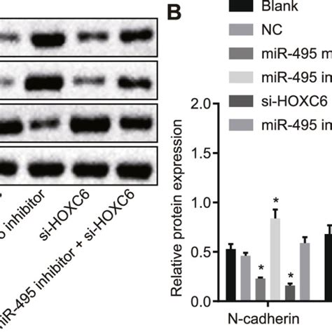 Upregulation Of Mir 495 Or Hoxc6 Silencing Inhibits Emt In Cscs The