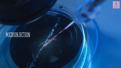 Microinjection Method Of Gene Transfer