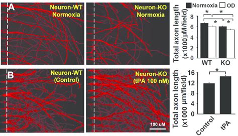 Both Neuronal And Exogenous Tpa Promoted Axonal Outgrowth A