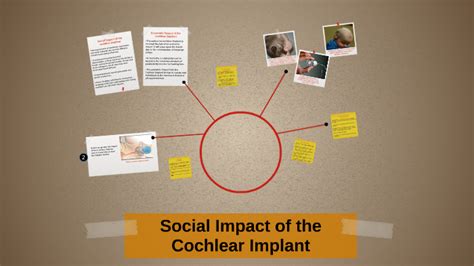 Social Impact Of The Cochlear Implant By Bianca Keane On Prezi