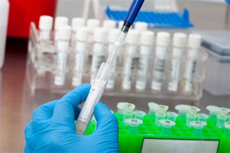 Closeup Of A Scientist Extracting DNA Using The Spin Column Based