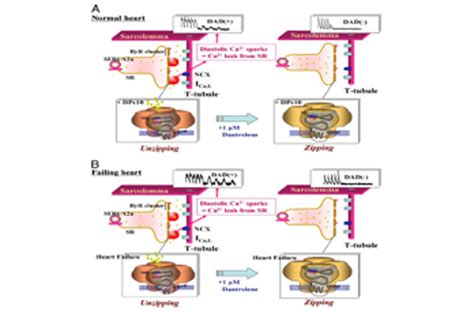 Malignant Hyperpyrexia
