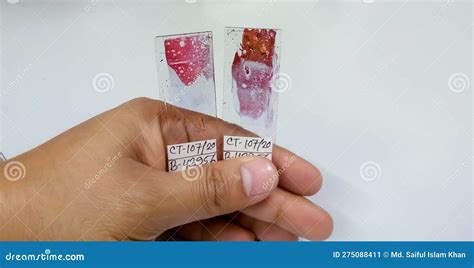 Doctor Holding Microscopic Glass Slide For The Diagnosis Of Cytology Department Laboratory