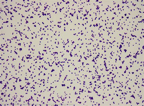 Staphylococcus Epidermidis Morphology