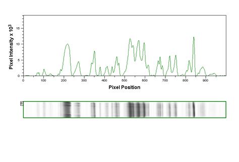 2 Sds Page Image And Electropherogram Of A Respresentative Sample From Download Scientific