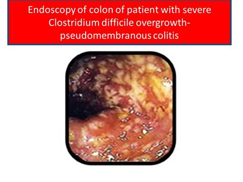 William Shaw Phd The Great Plains Laboratory Inc Ppt Video Online Download