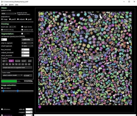 Recommended Image Enhancement Before Cellpose Analysis Image Analysis