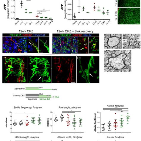 Comparative Transcriptome Analysis Reveals Brain Region Dependent