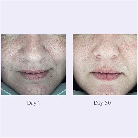 Youth Lab Dark Spot Remover Serum 30ml Fast Shipping And Expert Suppor