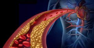 Simple And Effective Ways To Lower Cholesterol Naturally