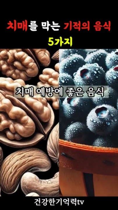필수 음식 치매예방에 좋은 음식 5가지 살펴봐요 Youtube