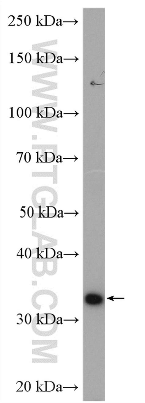 Spermidine Synthase Rabbit Anti Human Mouse Rat Polyclonal