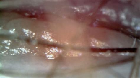 Fertile Hairy P O Vore 1080hd Nicoletta Embassi Clips4sale