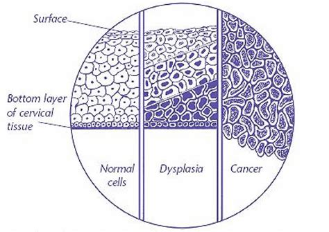Normal And Abnormal Cells
