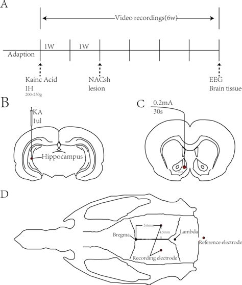 Nucleus Accumbens Shell Lesions Alleviate Symptoms In Kainic Acid