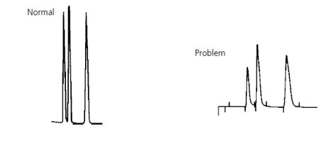 Causes And Remedy For HPLC Troubleshooting