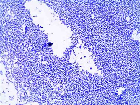 Simple Stain Staphylococcus Aureus