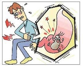 急性肾炎的症状图片 急性肾炎图片大全 急性肾炎 39疾病百科