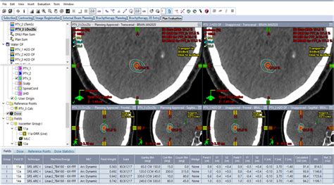 3d absolute isodose distributions were kept the same between the two download scientific