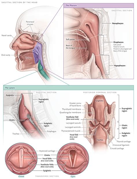 Acute Upper Airway Obstruction Nejm