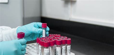 Eritrocite Crescute La Adulti Sau Copii Ce Inseamna Mami Si Copilul