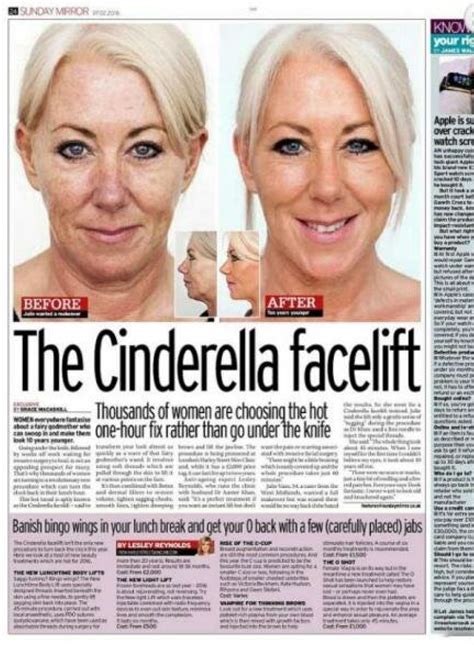 Cinderella Facelift Beauty Medical Clinic