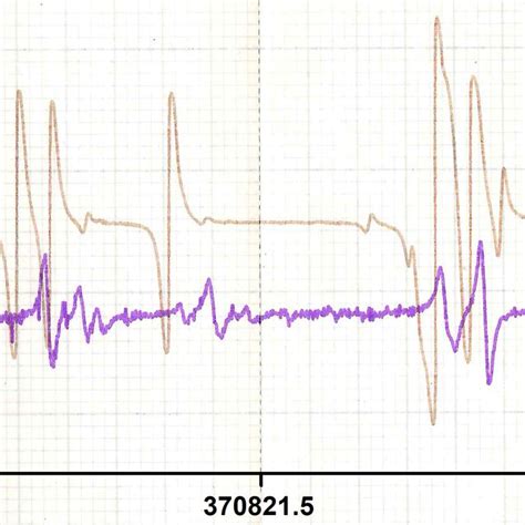 Small Portion Of Recorded In The Late 80 Ties Tunneling Rotation Download Scientific Diagram
