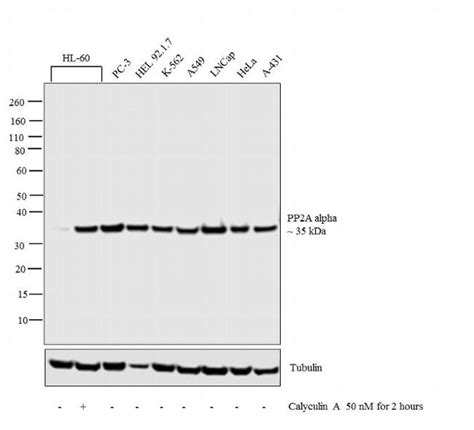 Pp2a Alpha Antibody Pa5 17510