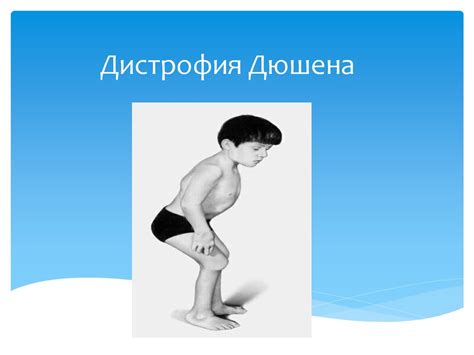 Мышечная дистрофия презентация онлайн