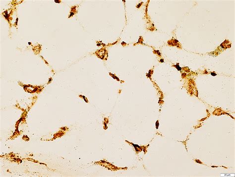 Hemosiderin Structure