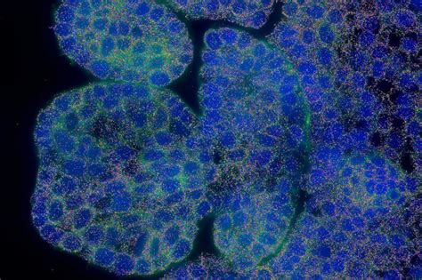 How To Use Spatial Transcriptomics To View Single Plant Cells In Situ