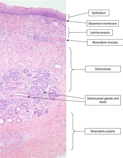 Lamina Propria Basement Membrane
