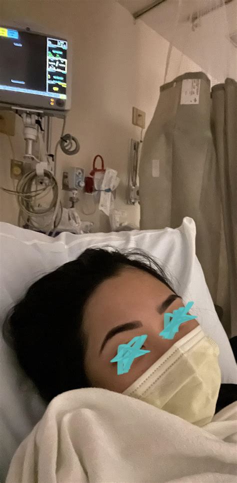 Scabs Still Attached After 15 Days Is This Normal I Keep On Reading They Are Meant To Fall